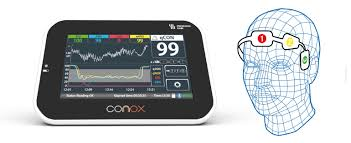 Q：Conox 定量的脳波モニターとは？: 麻酔科勤務医のお勉強日記