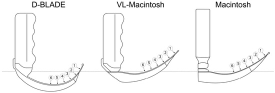 C-MAC D-BLADE とマッキントッシュ型ブレードによる喉頭鏡検査時の力分布の比較：無作為化比較臨床試験: 麻酔科勤務医のお勉強日記